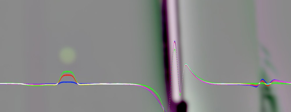 A Quick Tutorial on Digital Painting and Spatial Frequencies - befores ...